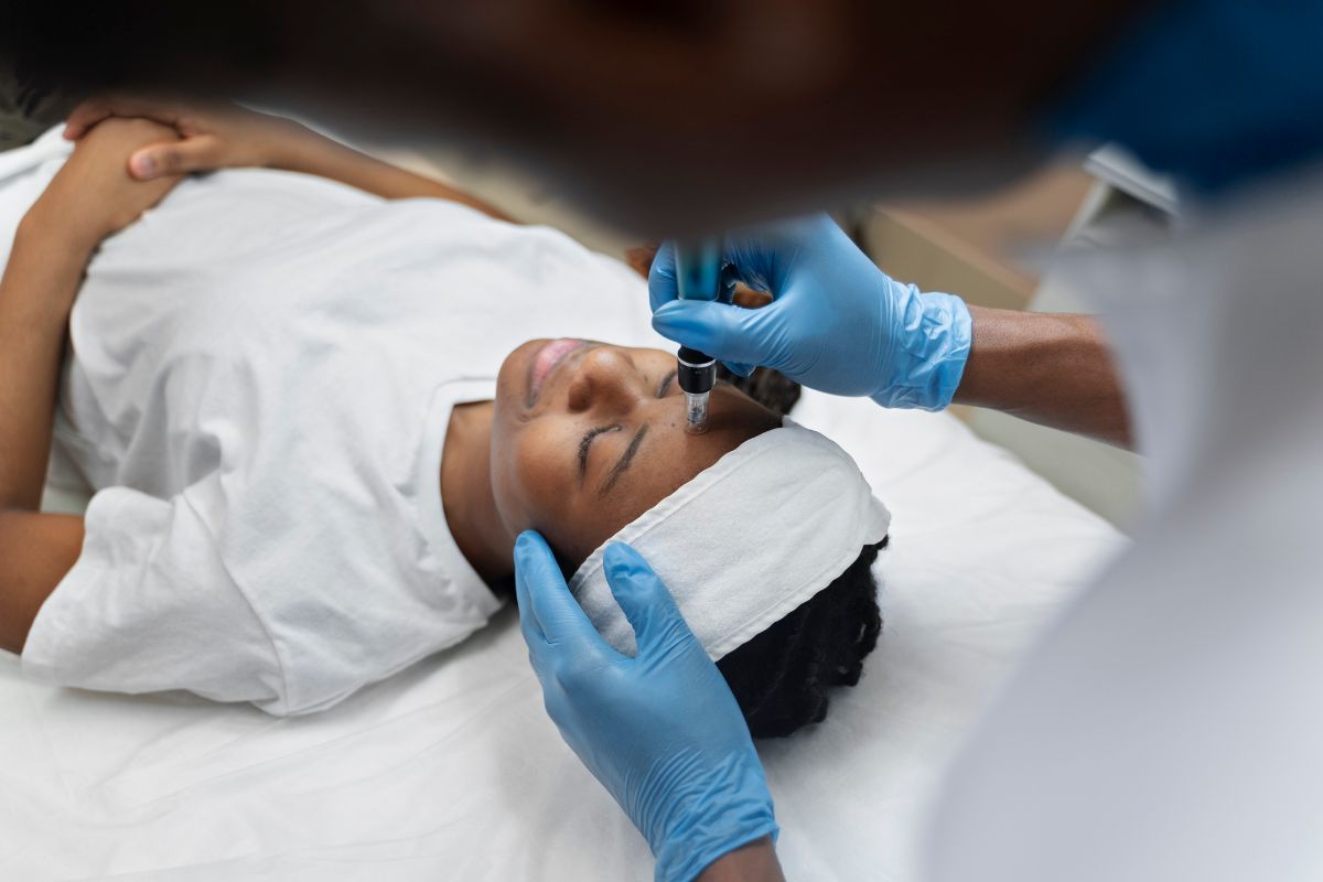 Microneedling Face And Neck